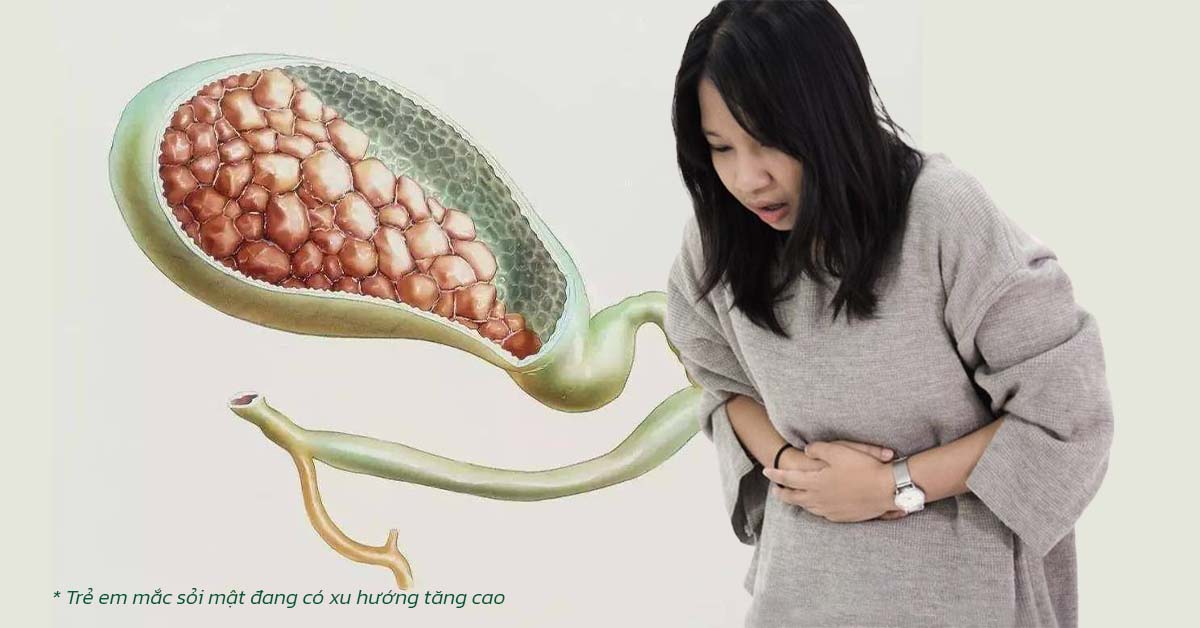 soi-tui-mat-o-tre-em-nguyen-nhan-va-cach-dieu-tri-1 - Sỏi Mật Trái Sung