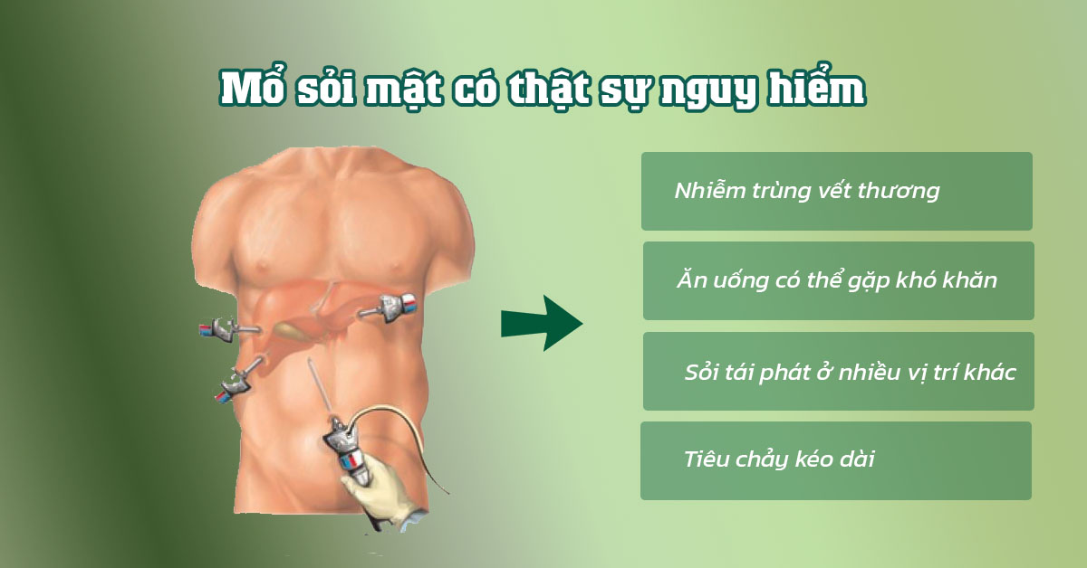 truong-hop-nao-nen-mo-soi-mat-2 - Sỏi Mật Trái Sung