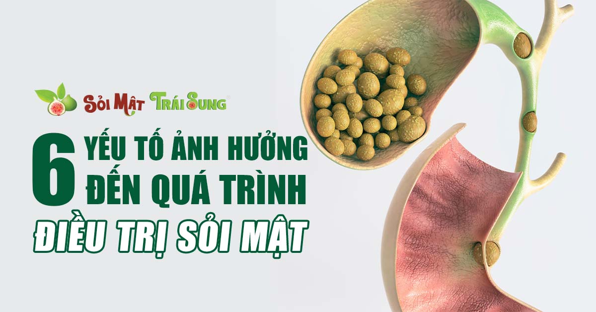 6 Mẹo dân gian đánh tan sỏi mật nhanh và hiệu quả nhất